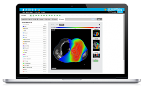 Sun Nuclear, pour le contrôle qualité en radiothérapie, partenaire SEEmed
